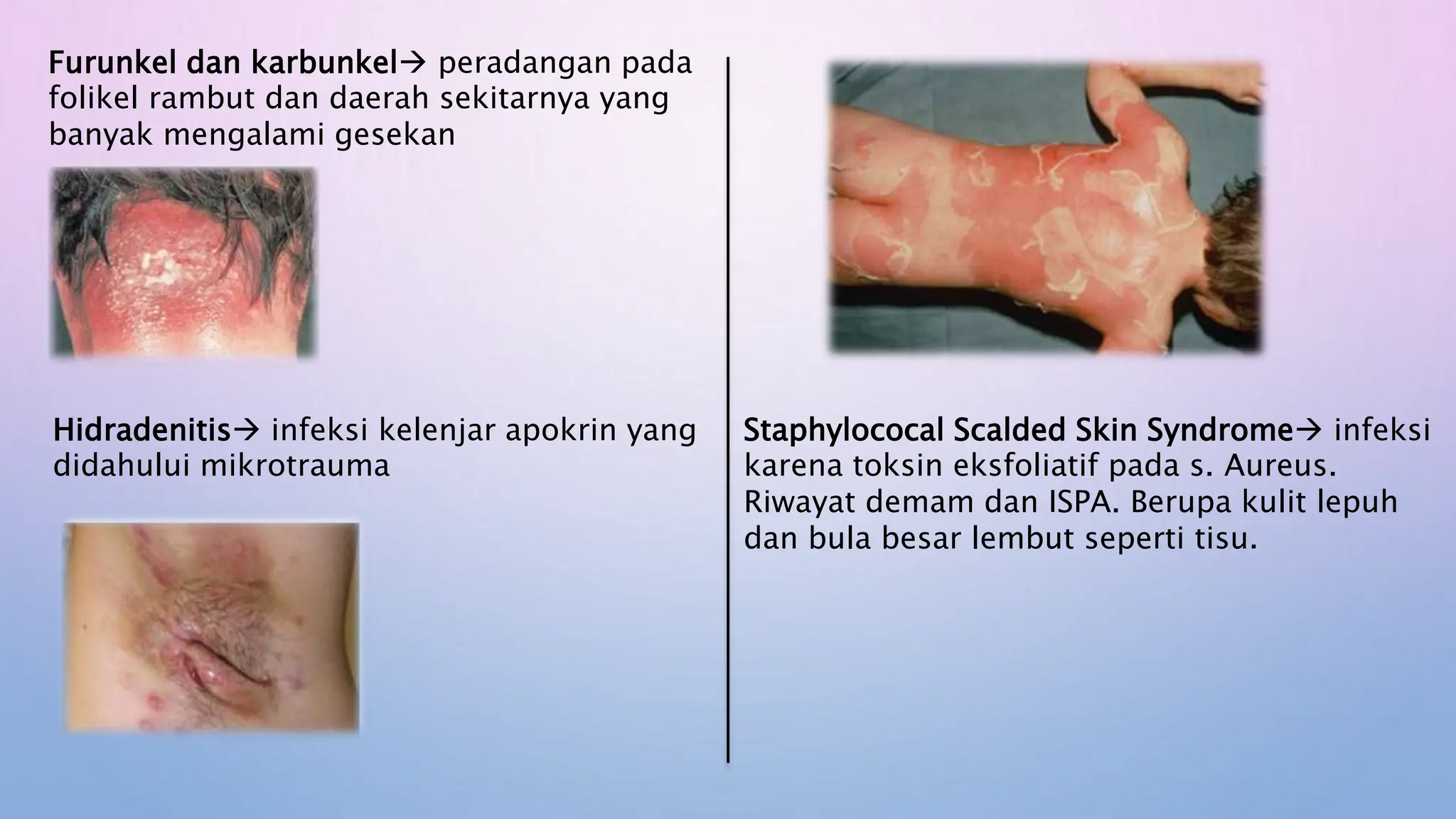 PPT Penyakit Kulit Infeksi Bakteri.pptx