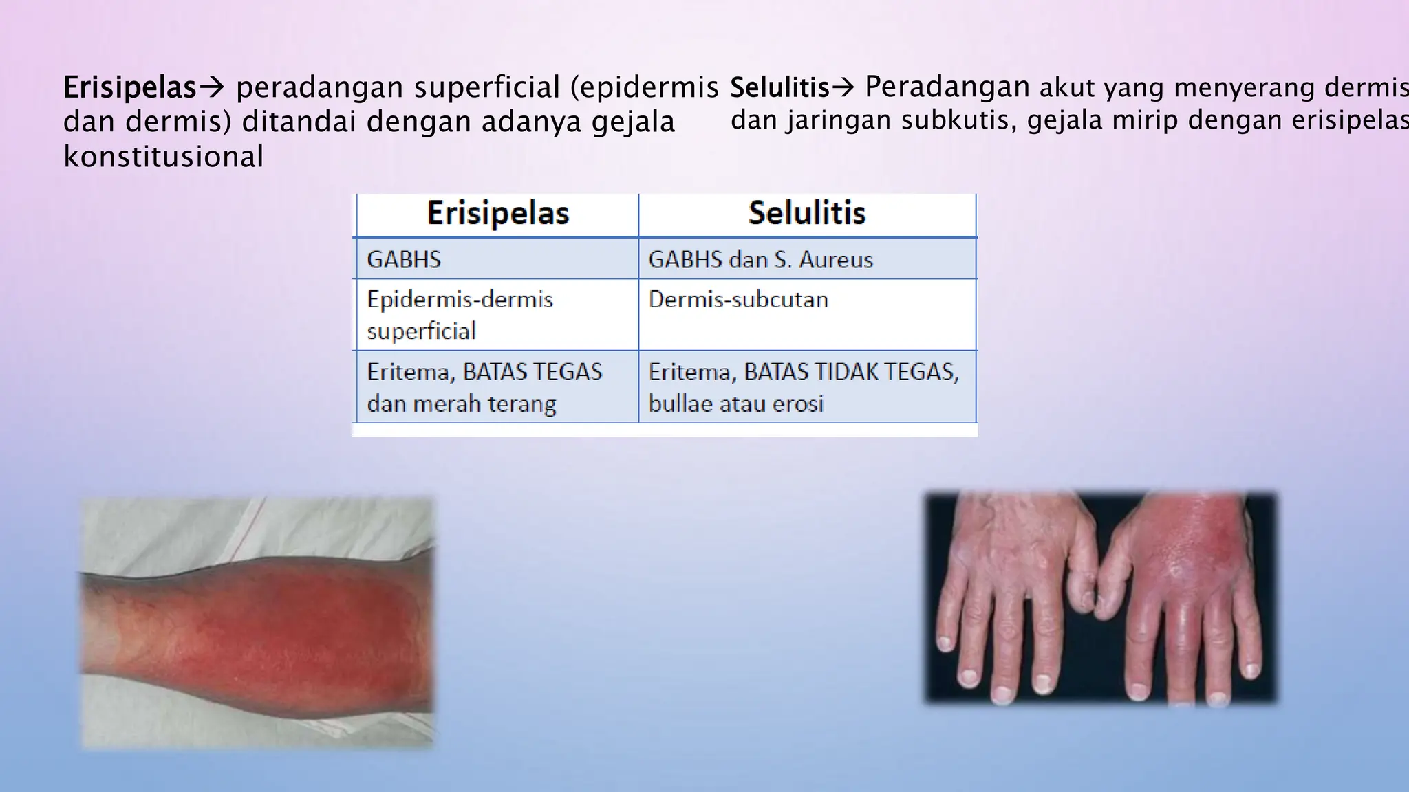 PPT Penyakit Kulit Infeksi Bakteri.pptx