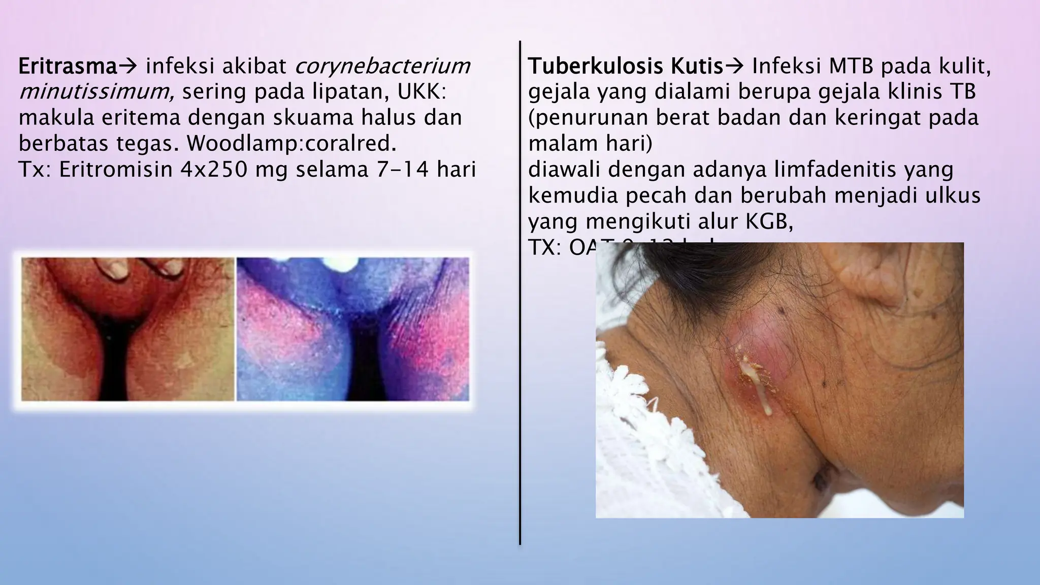 PPT Penyakit Kulit Infeksi Bakteri.pptx