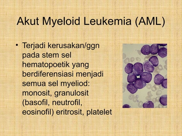 PENYAKIT LEUKIMIA DI INDONESIA DAN DIDUNIA | PPTX