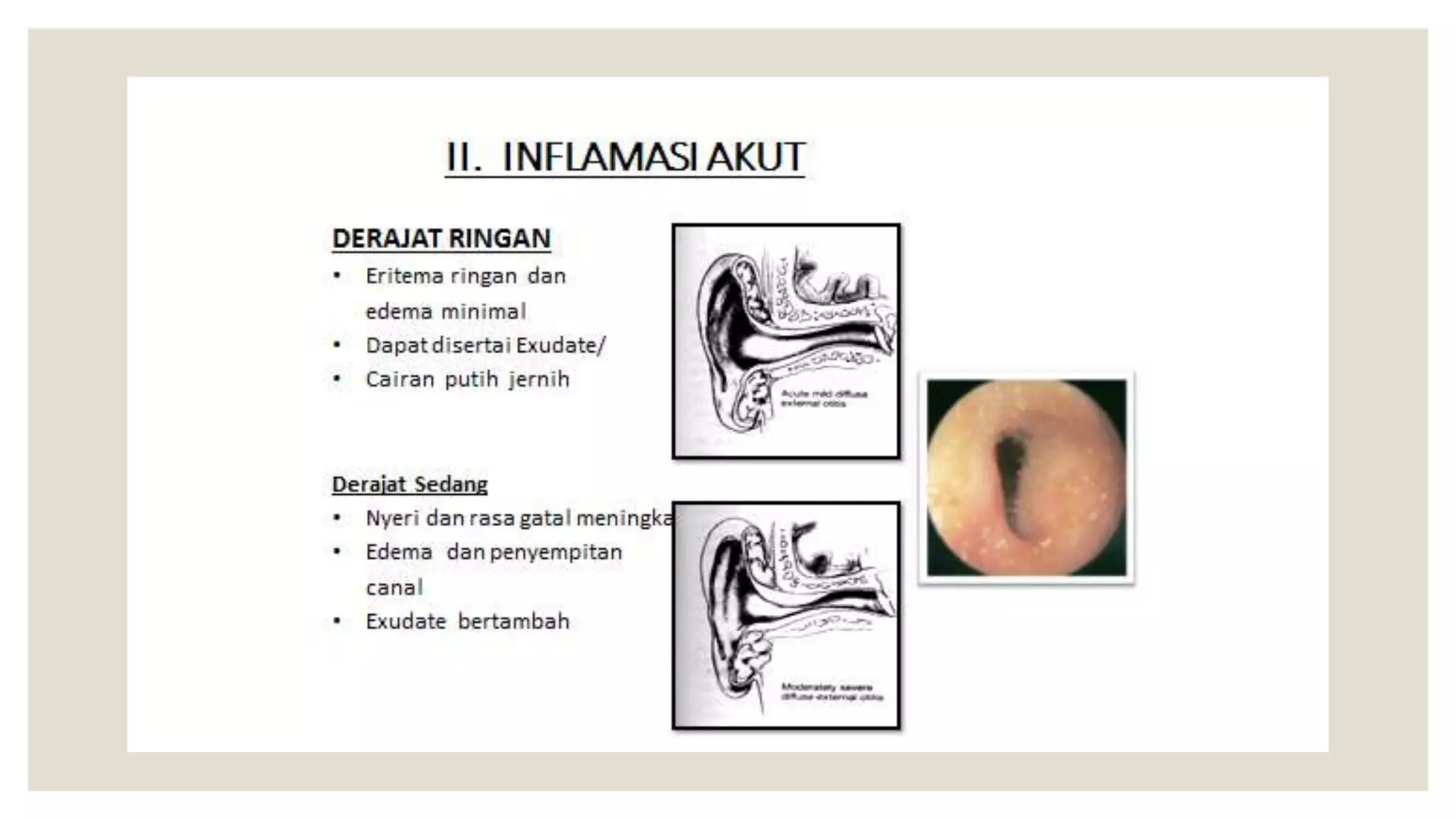 PENYAKIT LIANG TELINGA & INFLAMASI DAUN TELINGA.pptx