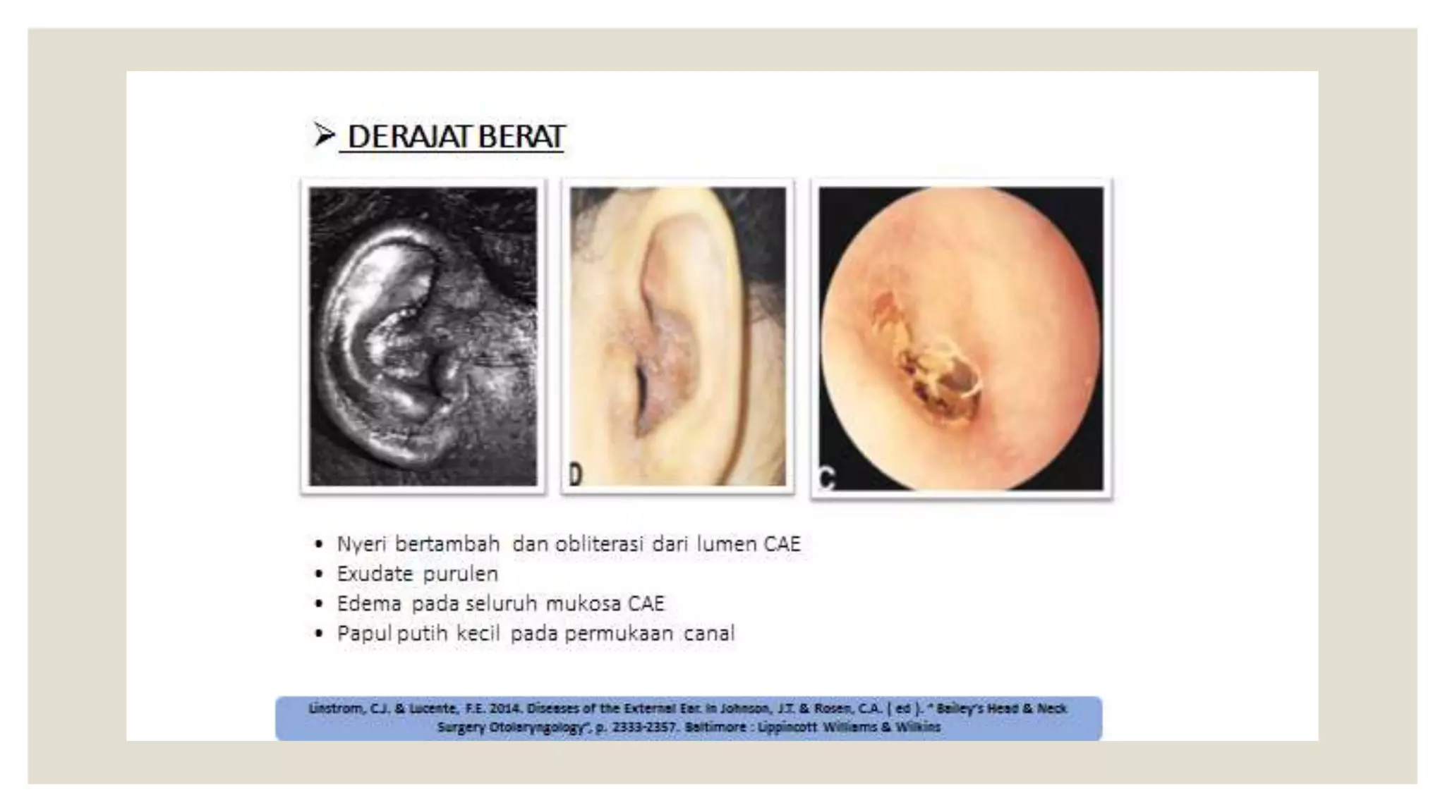 PENYAKIT LIANG TELINGA & INFLAMASI DAUN TELINGA.pptx