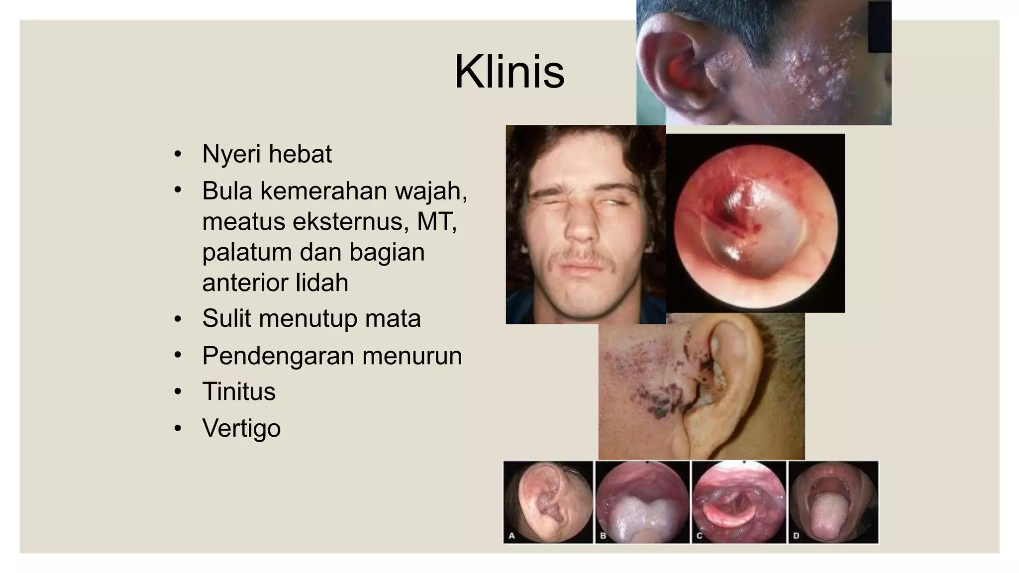 PENYAKIT LIANG TELINGA & INFLAMASI DAUN TELINGA.pptx