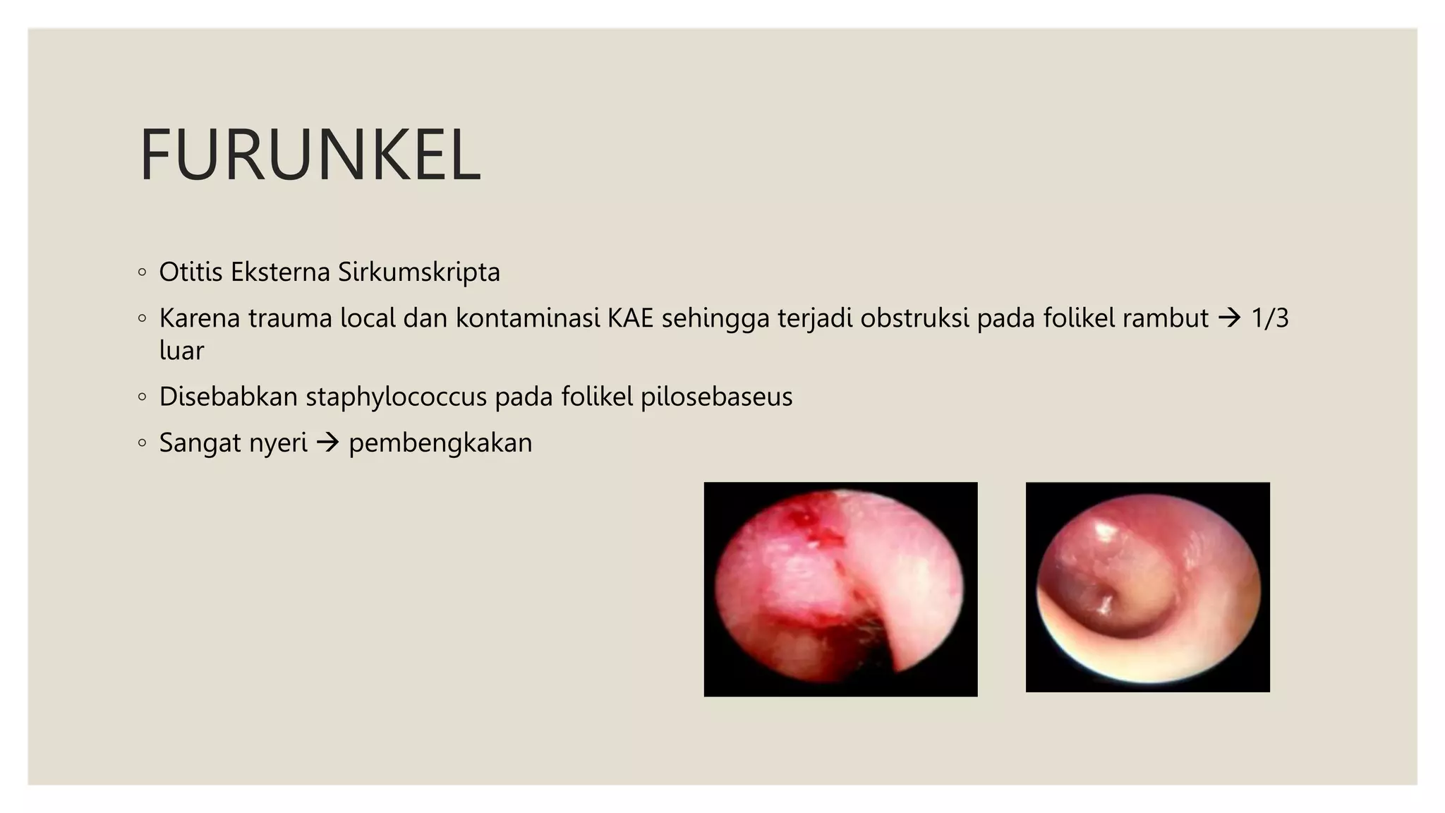 PENYAKIT LIANG TELINGA & INFLAMASI DAUN TELINGA.pptx