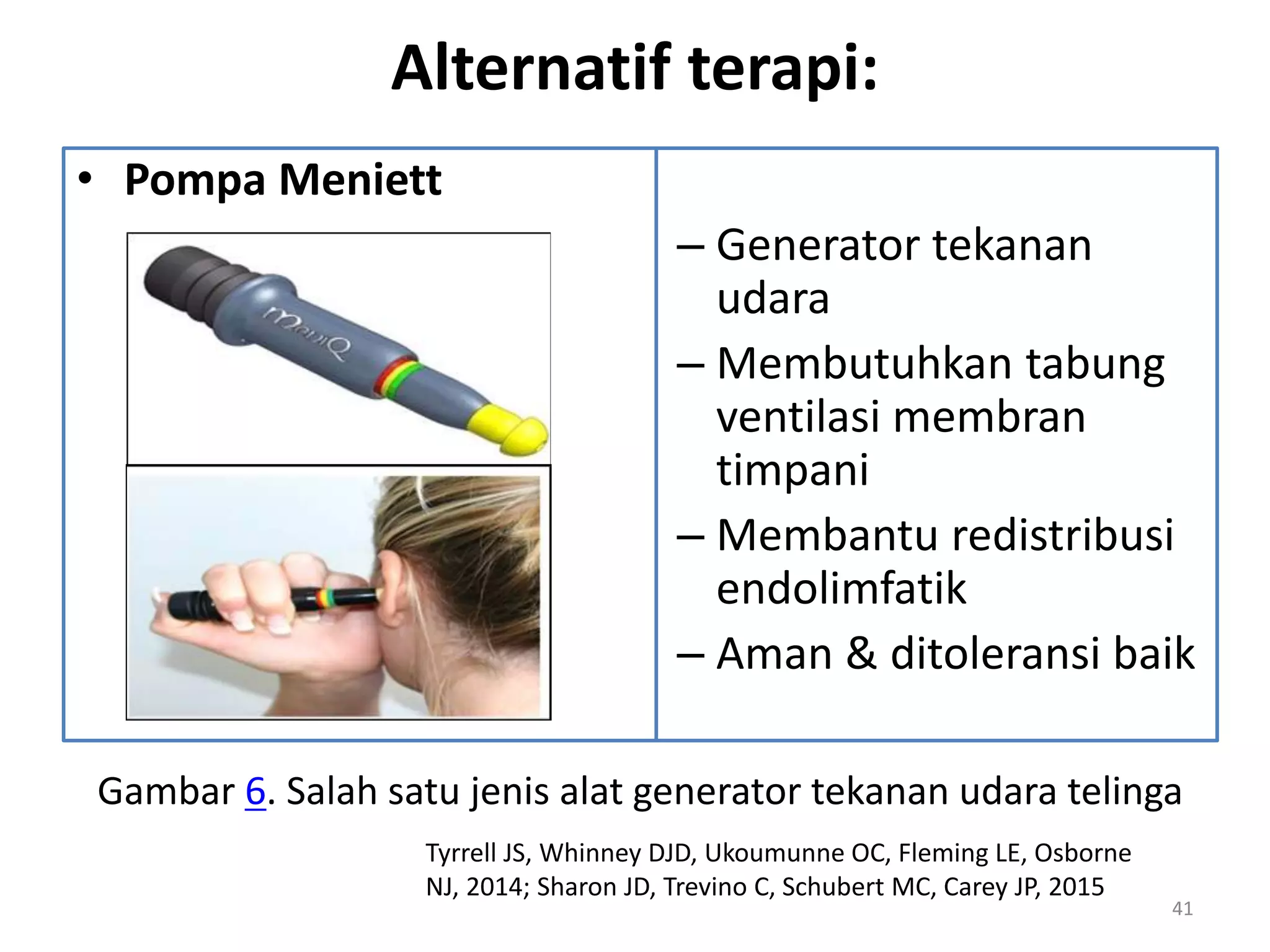 Penyakit Meniere | PPTX
