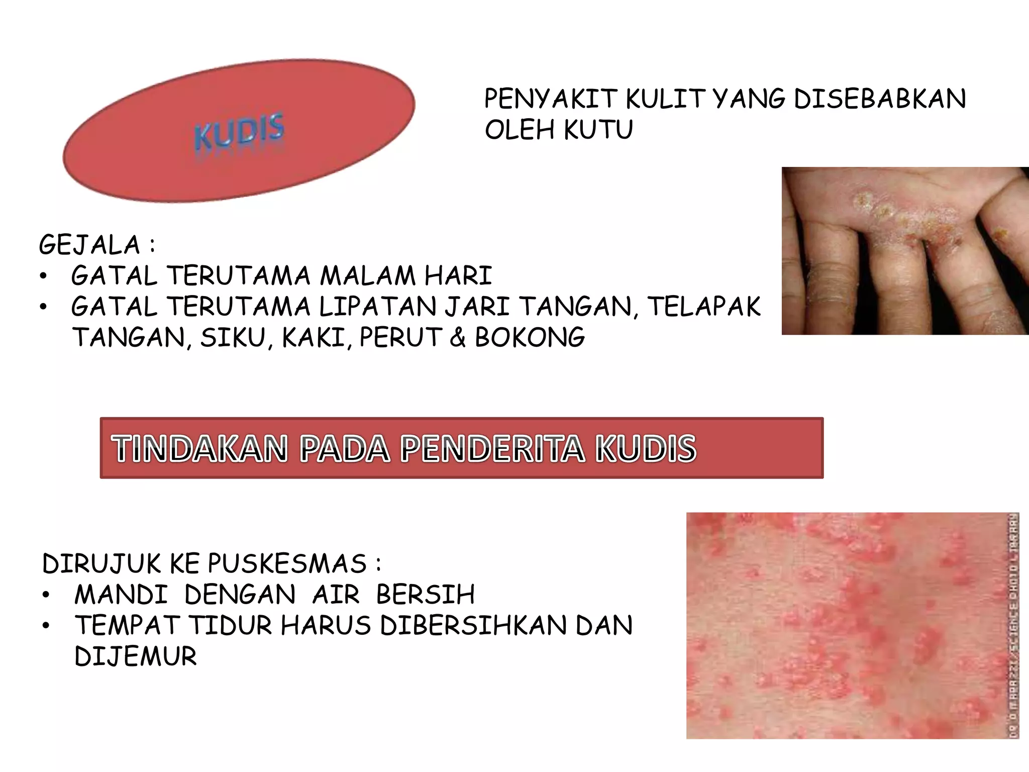 Penyakit menular | PPTX