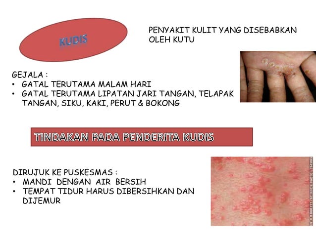 Penyakit menular | PPTX