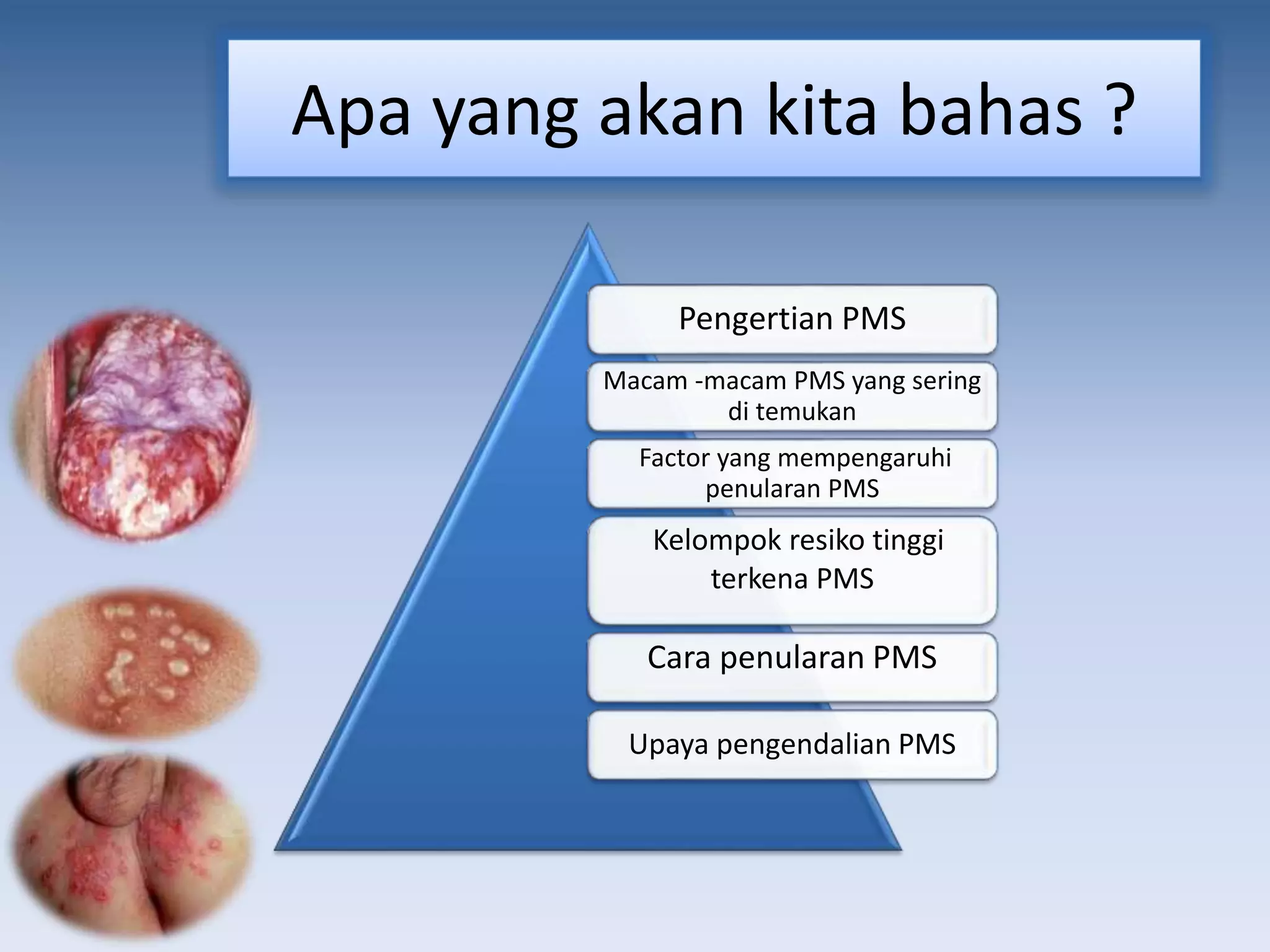 Penyakit menular seksual | PPTX