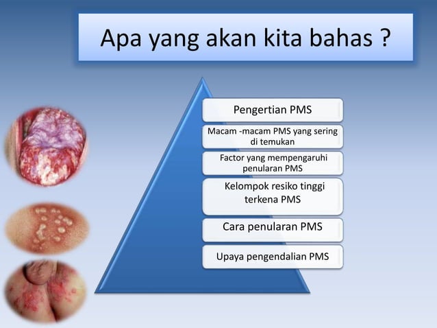 Penyakit menular seksual | PPTX