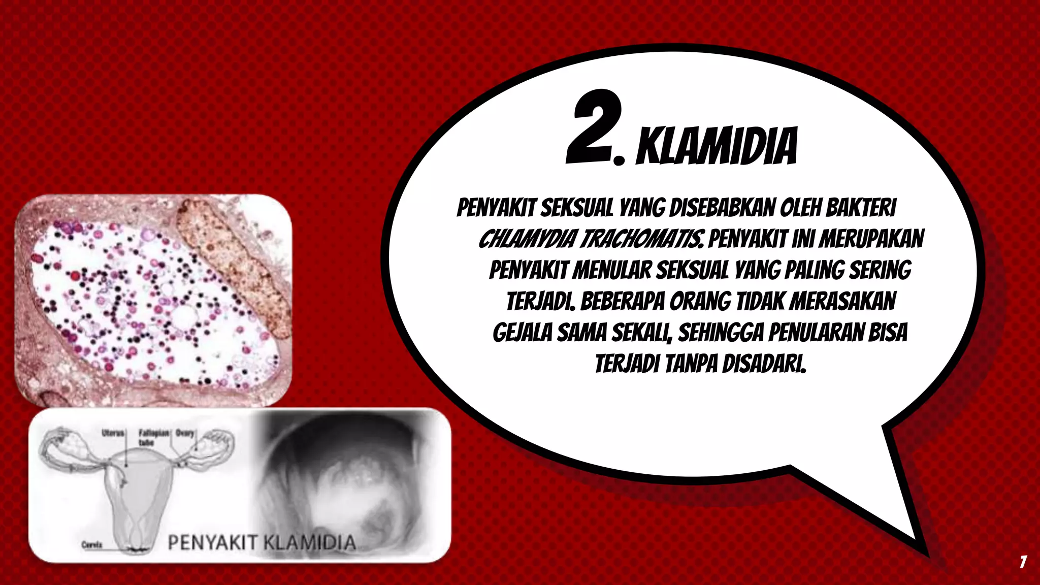 Penyakit menular seksual SMAN 7 TANGERANG | PPTX