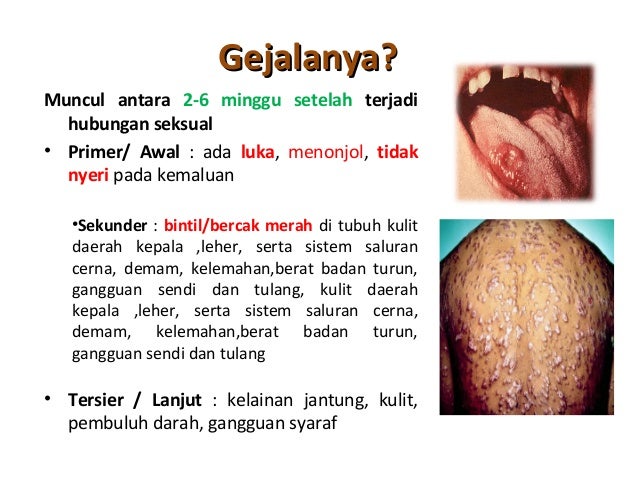 Penyakit Menular Seksual Pms Editted
