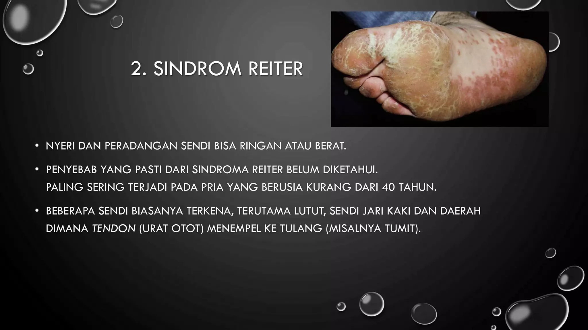 Penyakit pada ekstremitas atas dan ekstremitas bawah | PPTX