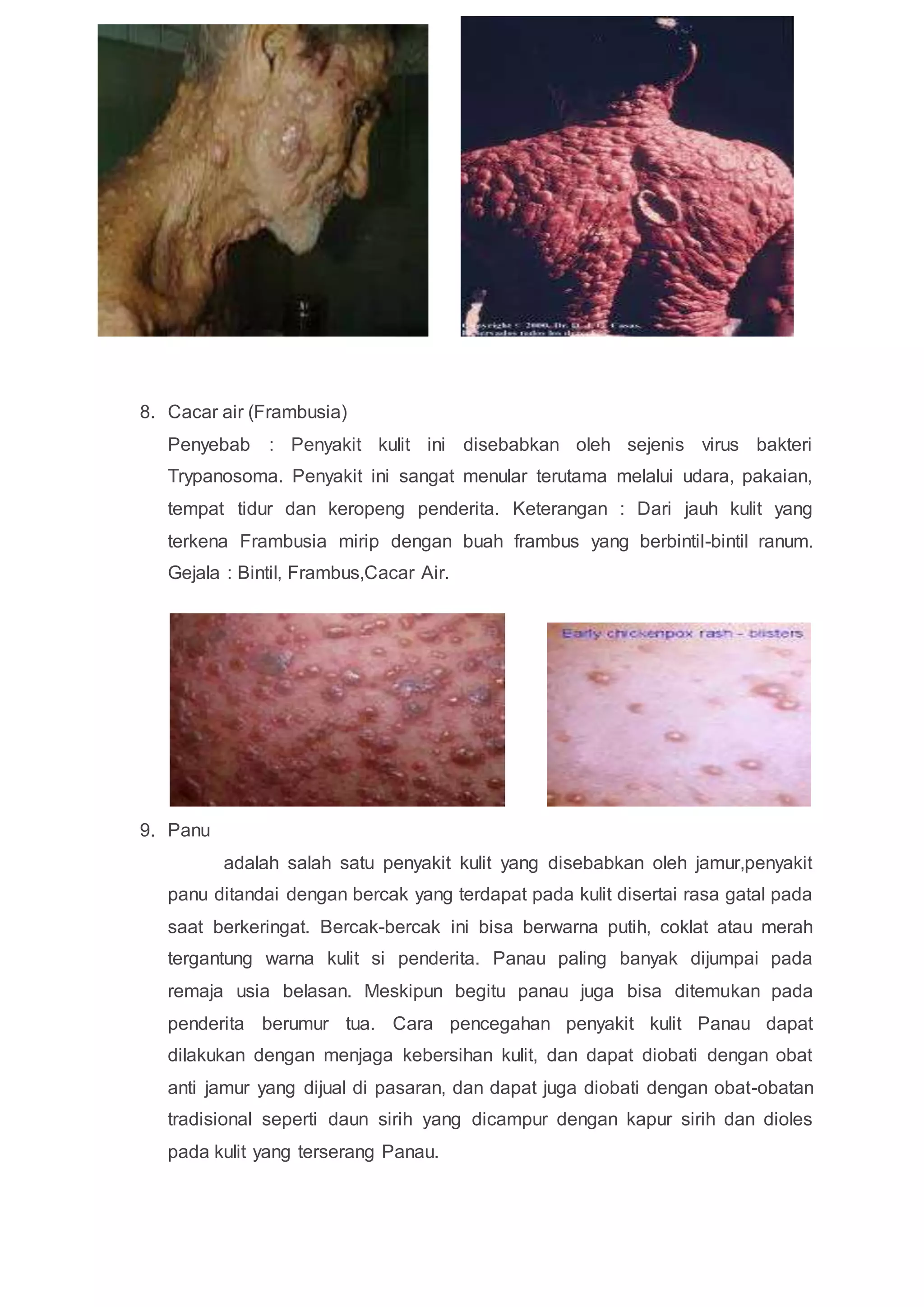 kelainan dan Penyakit pada kulit | DOCX