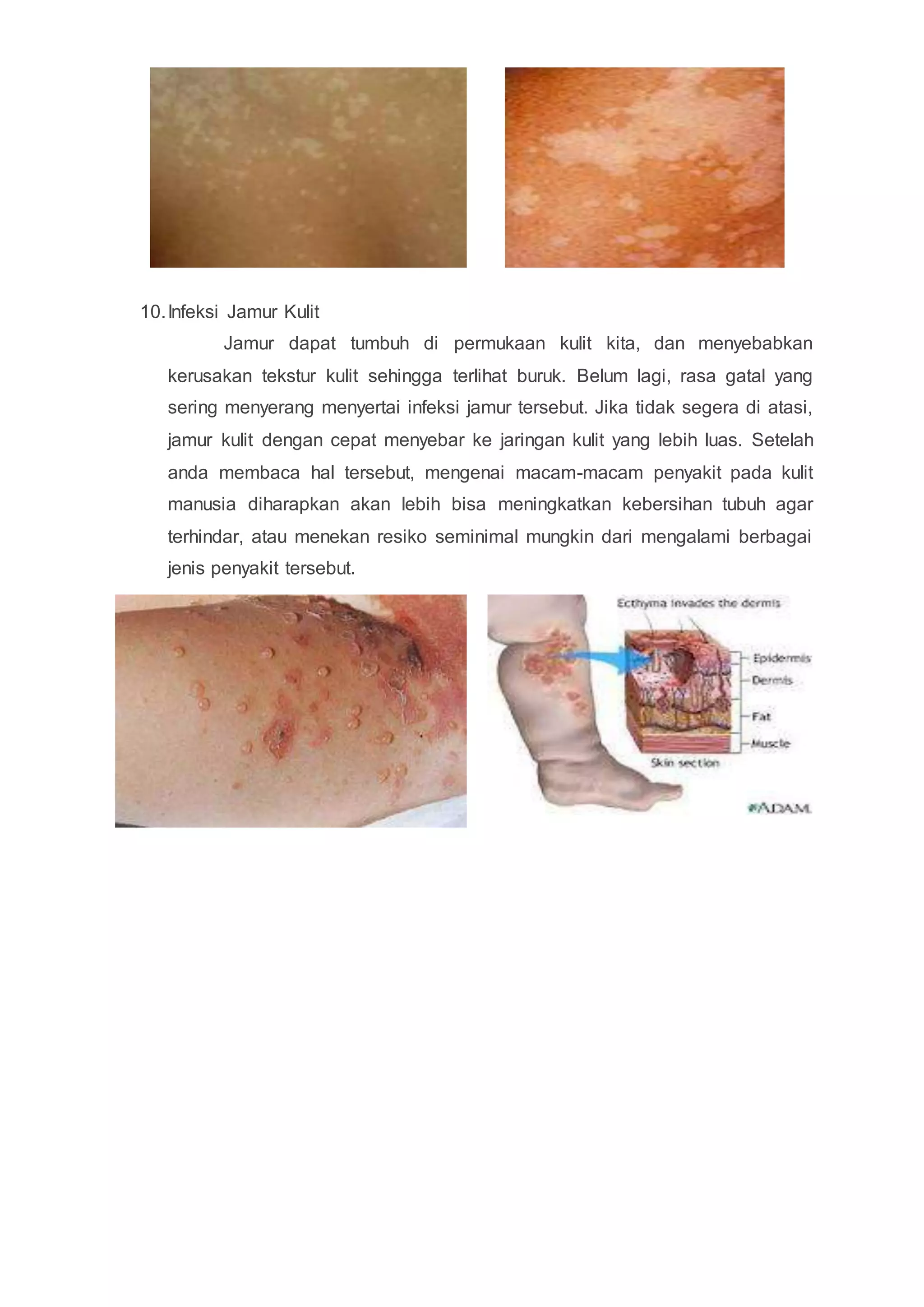 kelainan dan Penyakit pada kulit | DOCX