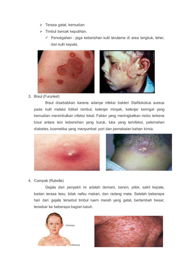 kelainan dan Penyakit pada kulit | DOCX
