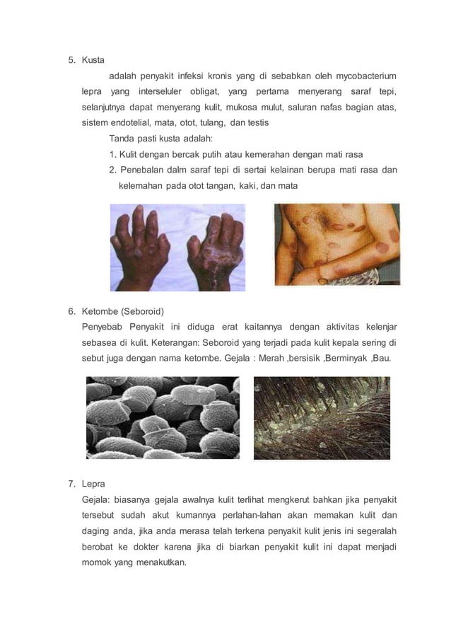 kelainan dan Penyakit pada kulit | DOCX