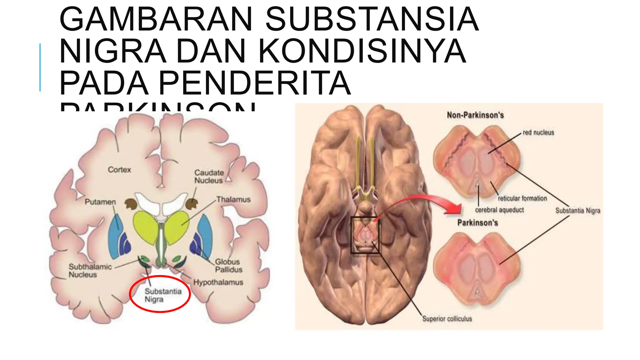 Tatalaksana Penyakit Parkinson secara farmakologi | PPTX