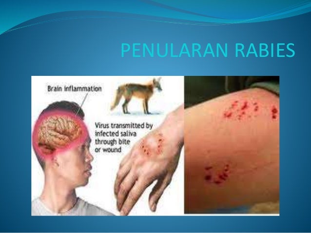 Penyakit rabies.PPT