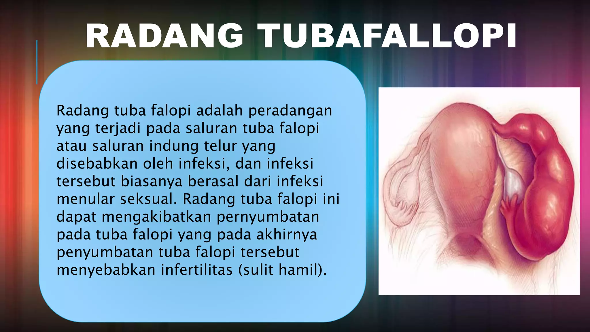 Penyakit radang panggul (pelvic inflammatory disease | PPTX