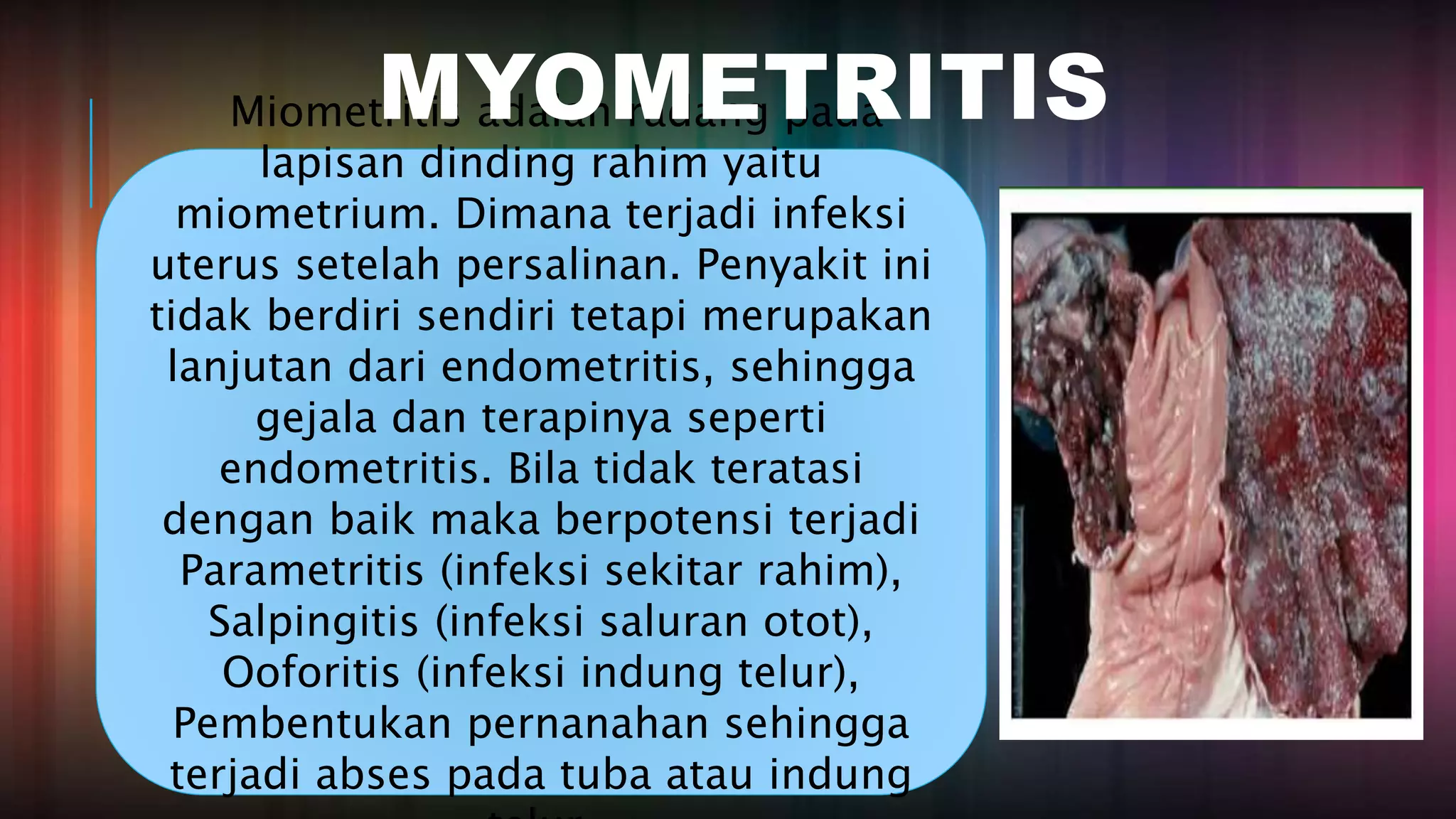 Penyakit radang panggul (pelvic inflammatory disease | PPTX