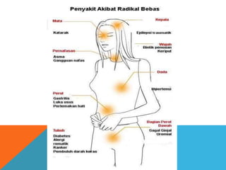 Penyakit yang disebabkan oleh radikal bebas | PPTX