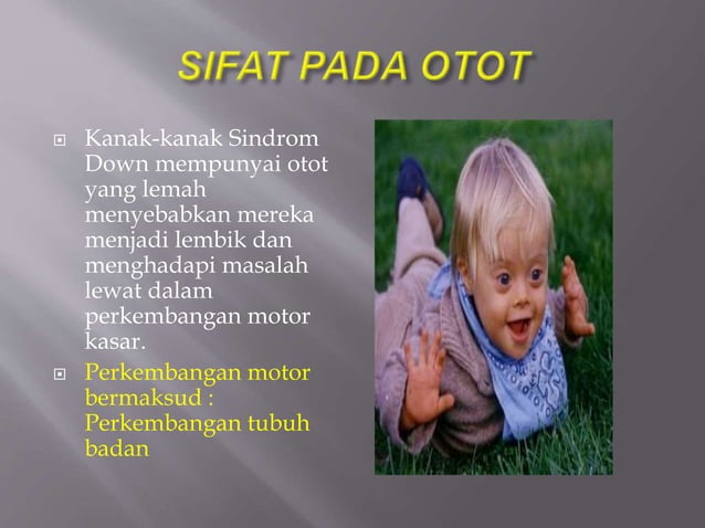 Penyakit sindrom down | PPT