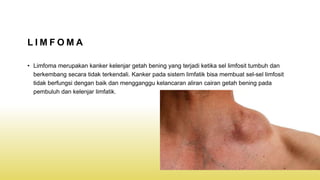 PENYAKIT SISTEM LIMFATIK.pptx