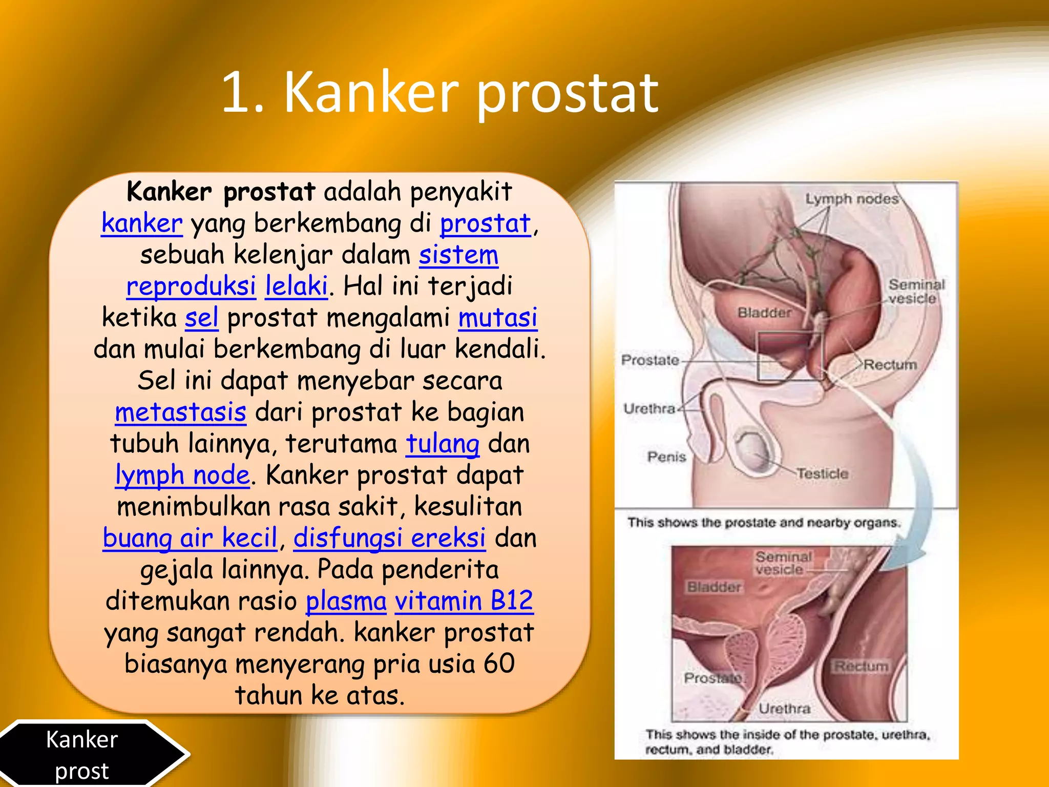 Penyakit sistem reproduksi | PPTX