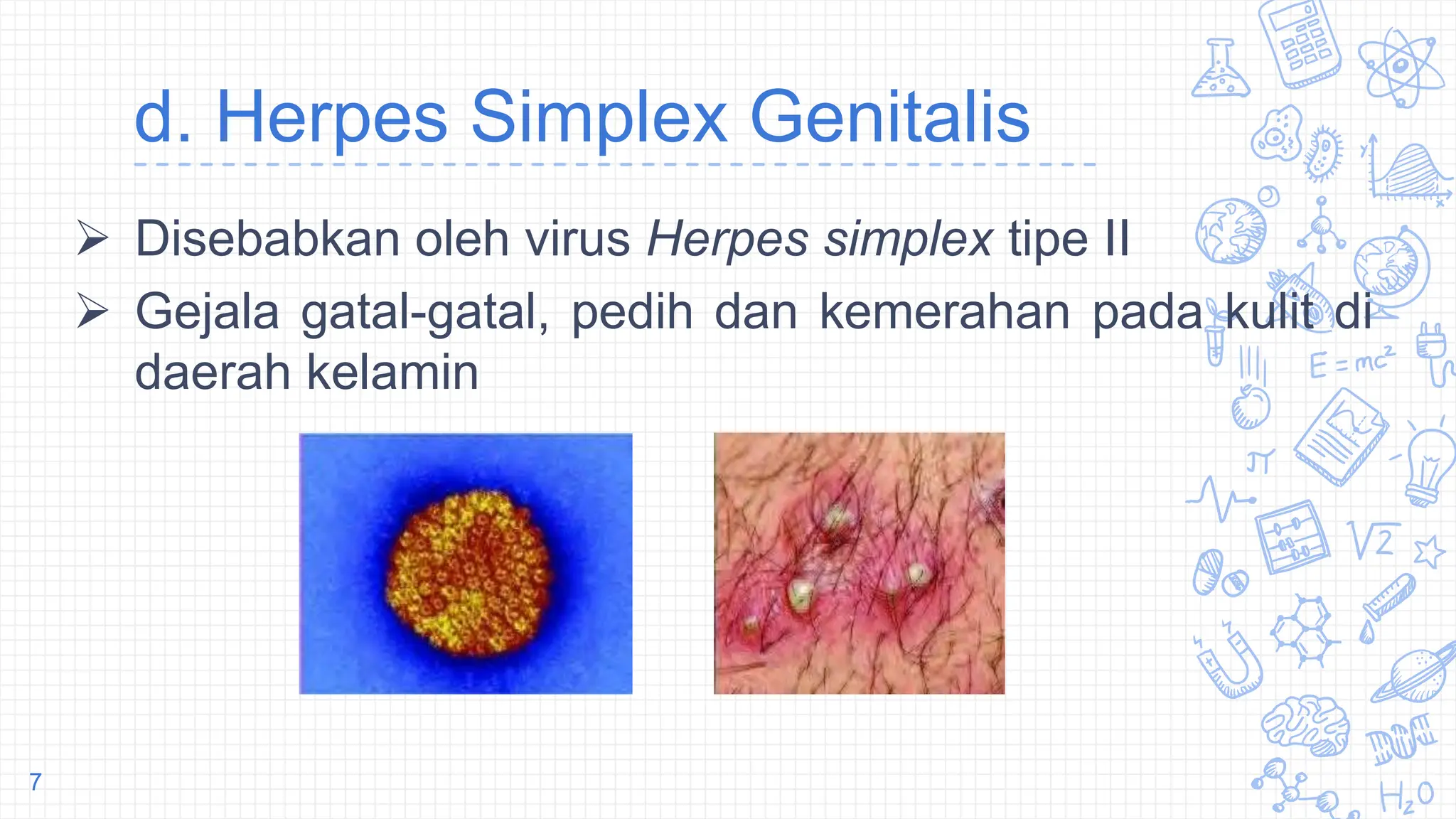 penyakit sistem reproduksi.pptx