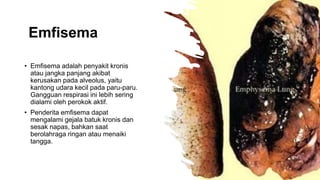 PENYAKIT SISTEM RESPIRASI.pptx