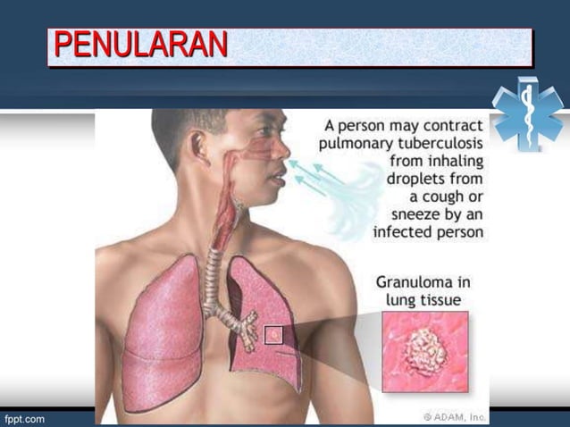 Penyakit TB.ppt