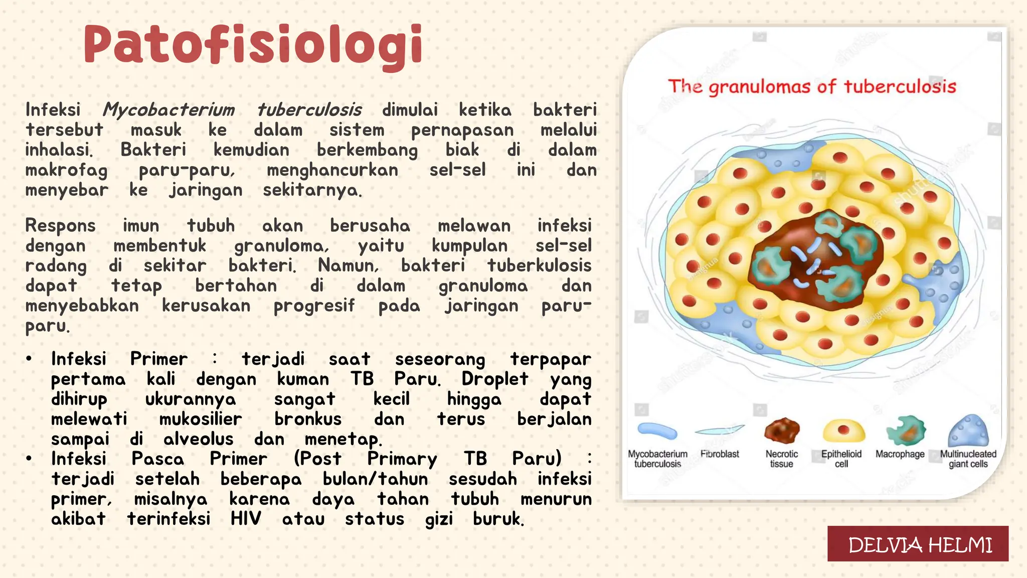 PENYAKIT TBC (tuberculosis) beserta obatnya | PPTX