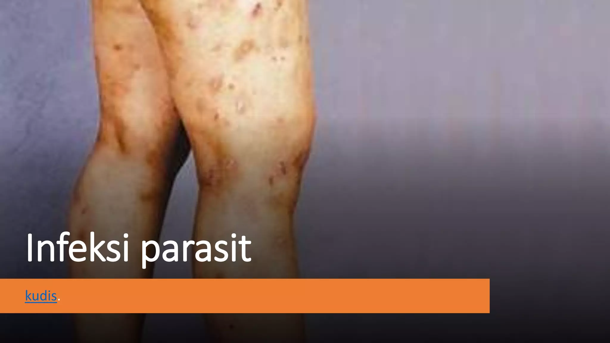 Penyakit terkait system intergumen .pptx