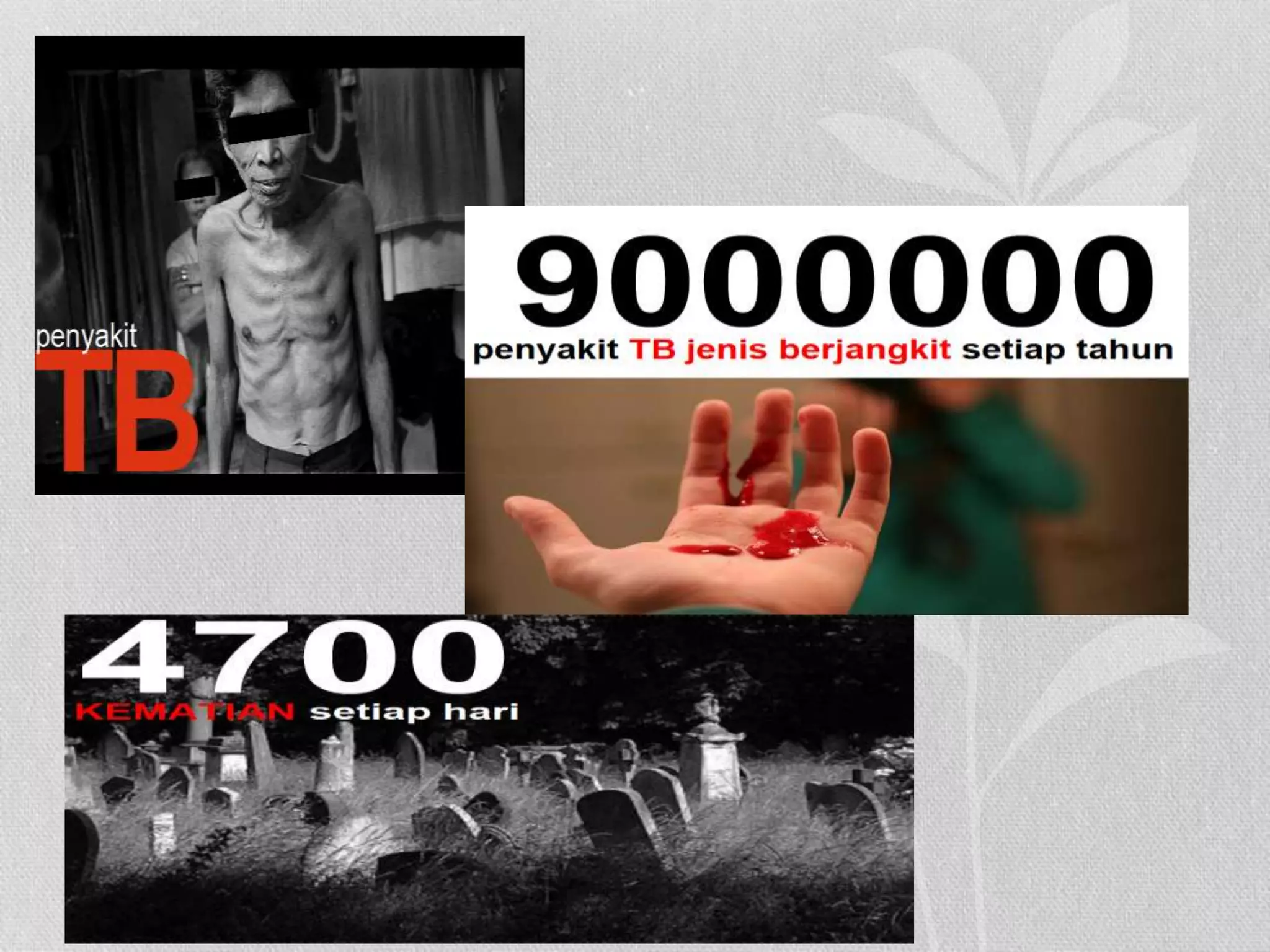 Penyakit tibi | PPTX