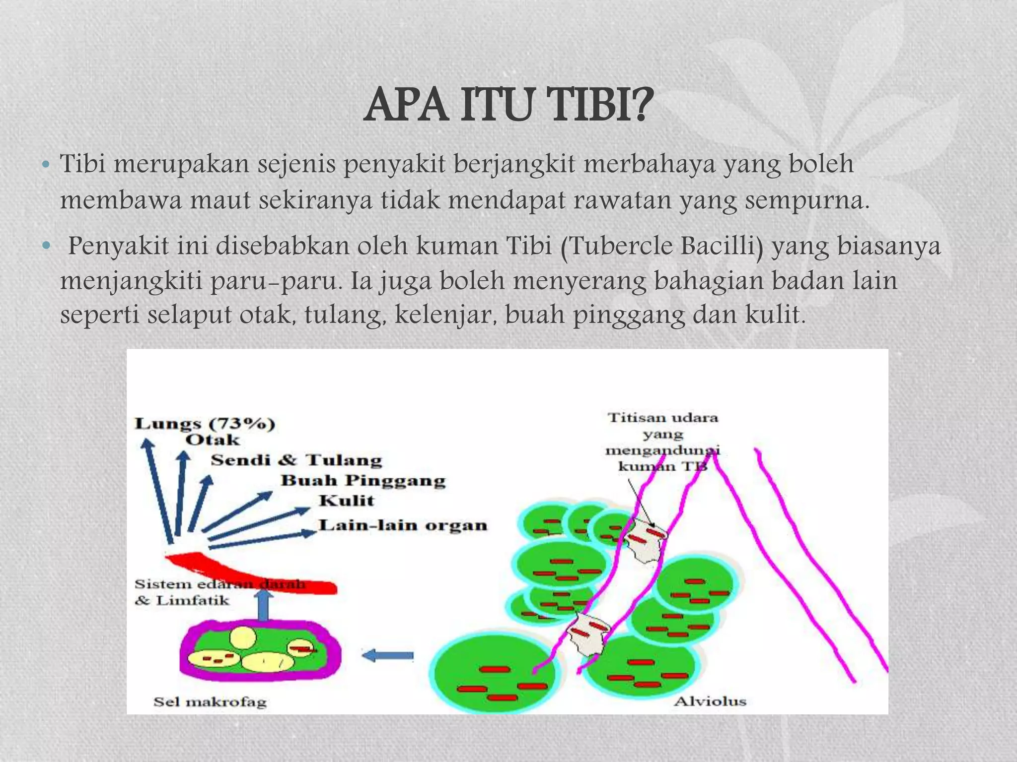 Penyakit tibi | PPTX