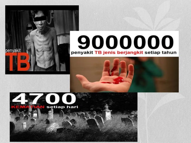 Penyakit tibi | PPTX