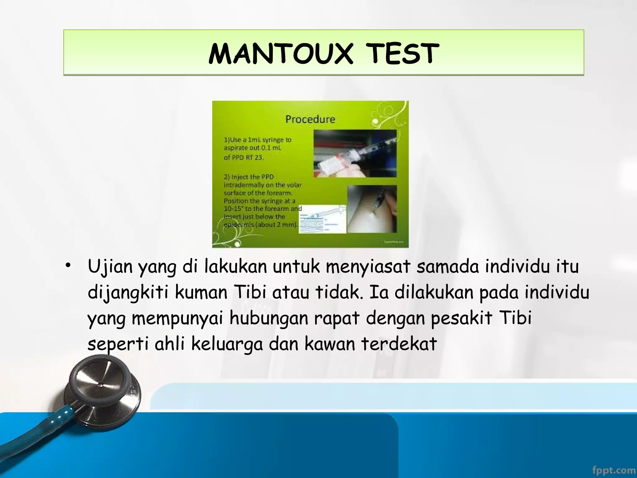 Penyakit tuberkulosis @ tibi dani | PPT