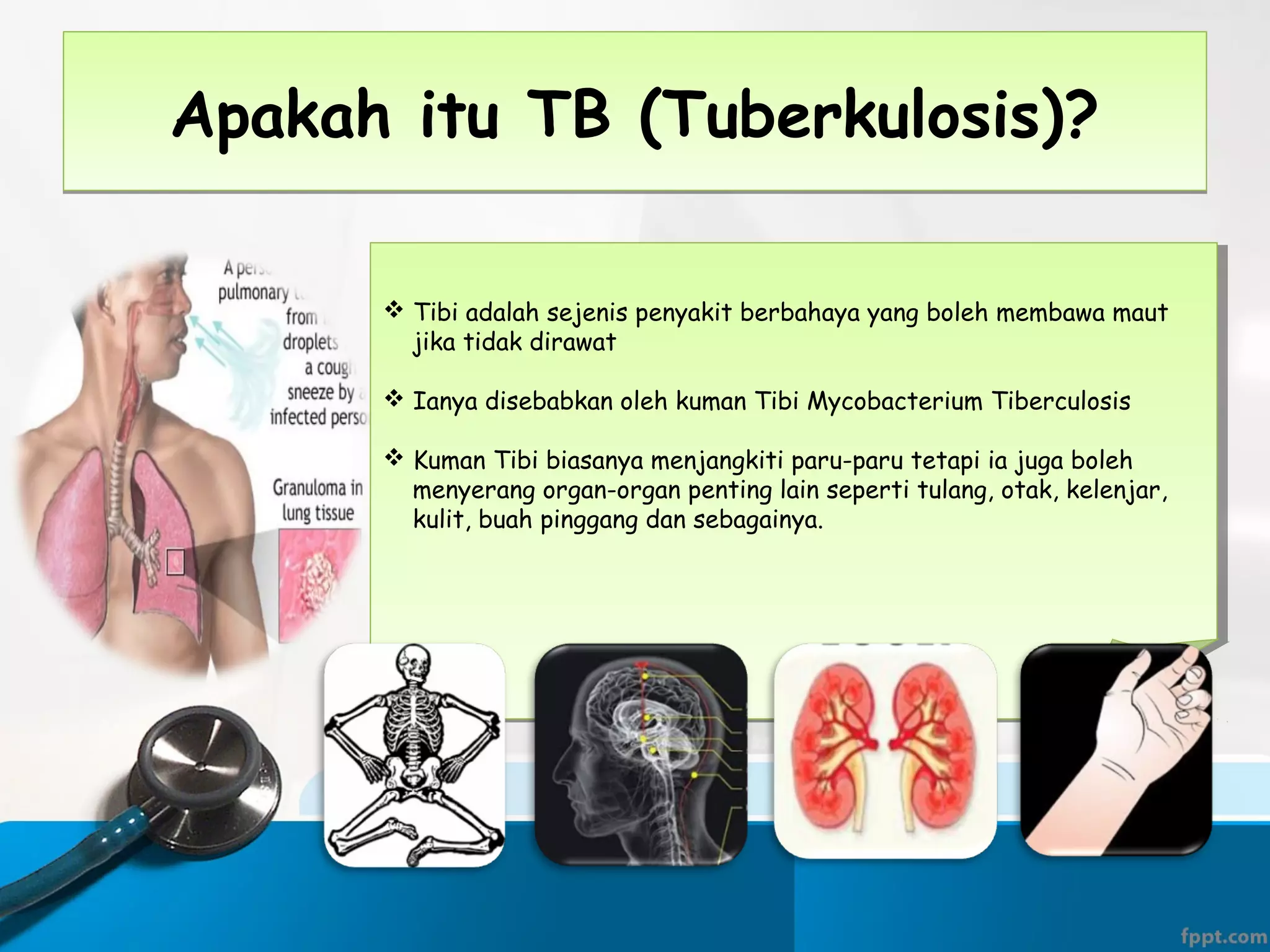 Penyakit tuberkulosis @ tibi dani | PPT