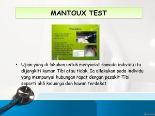Penyakit tuberkulosis @ tibi dani | PPT
