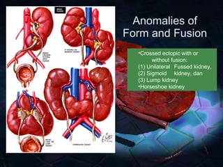 Penyakit urologi | PPT