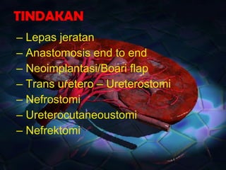 Penyakit urologi | PPT