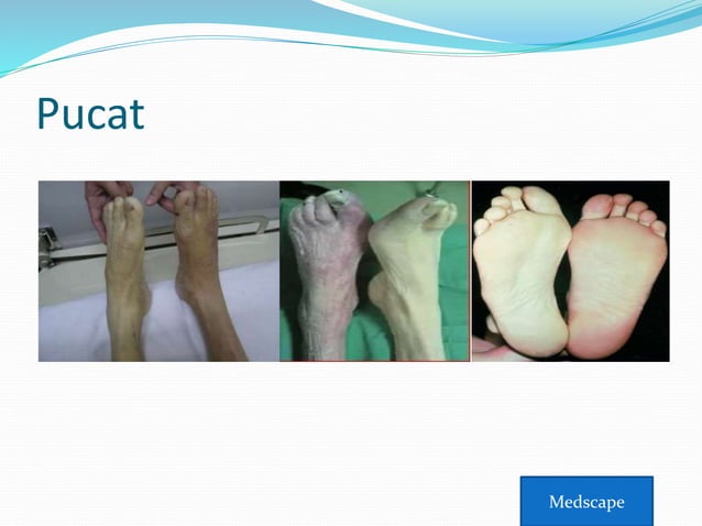 Penyakit vascular | PPTX