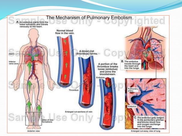 Penyakit vascular | PPTX