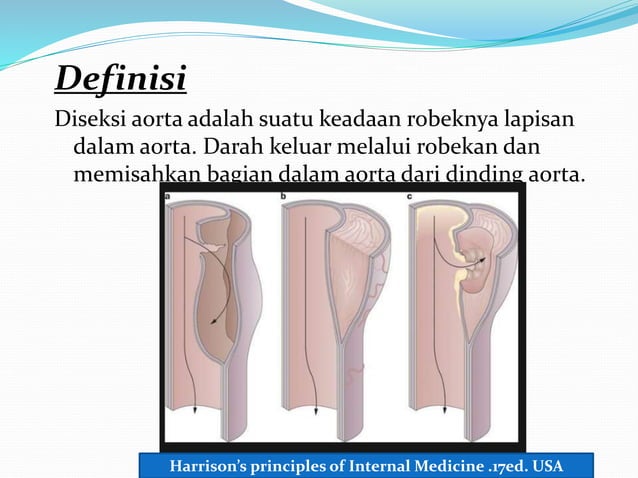Penyakit vascular | PPTX
