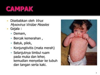 Penyakit yang dapat dicegah dengan imunisasi (pd3 i | PPTX