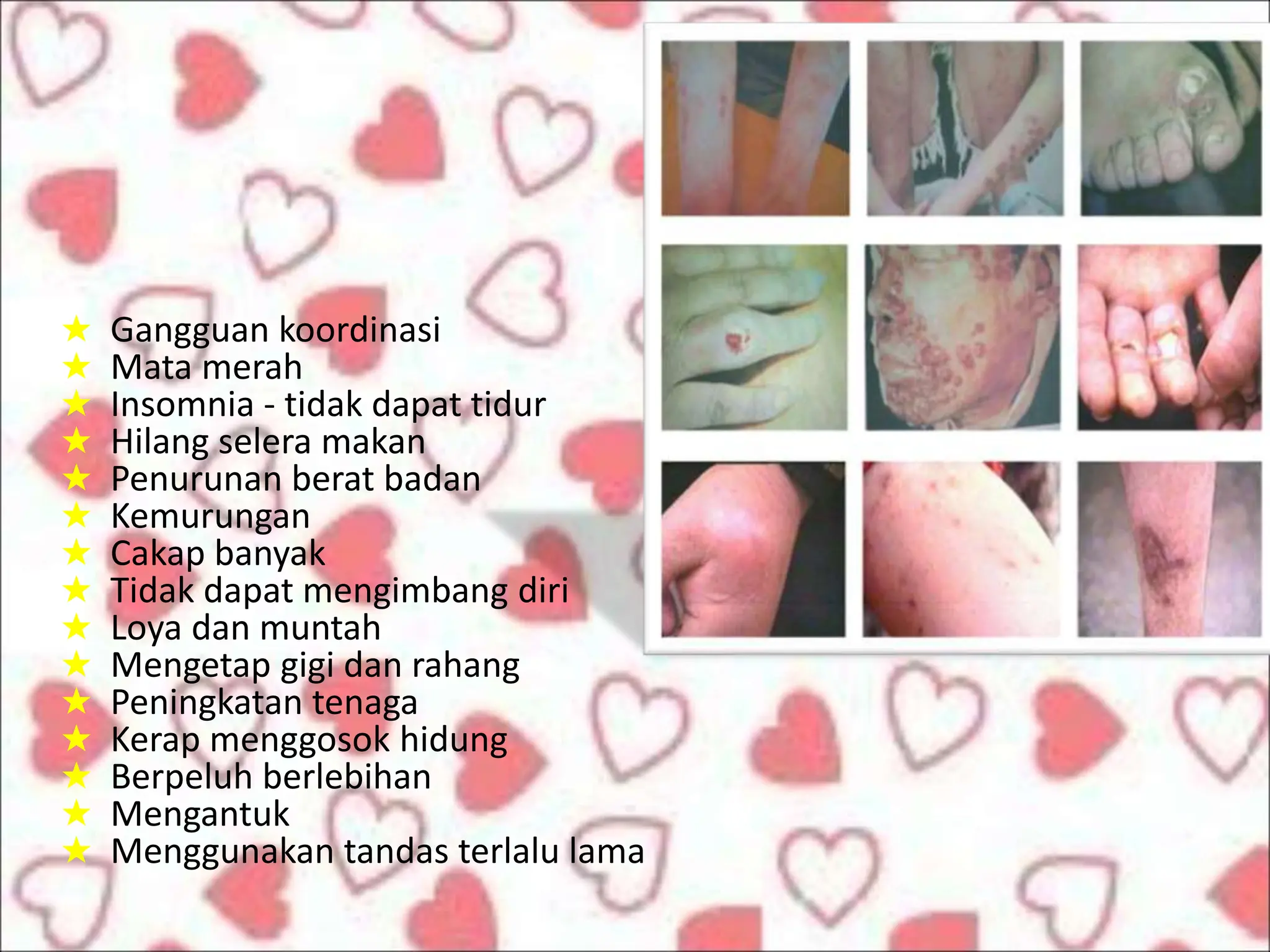 penyalahgunaan-dadah healthcare penyalahgunaan dadah | PPT