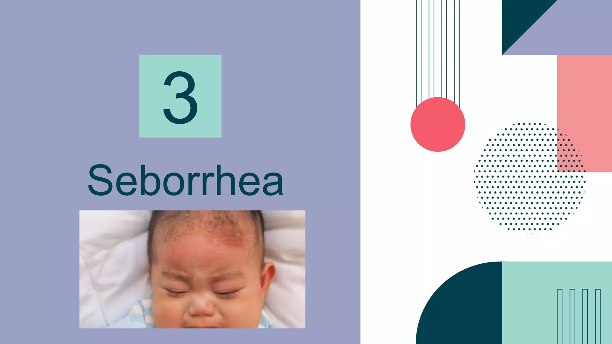 Penyulit dan Komplikasi Neonatus, bayi diaper rush, seborhea & oral ...