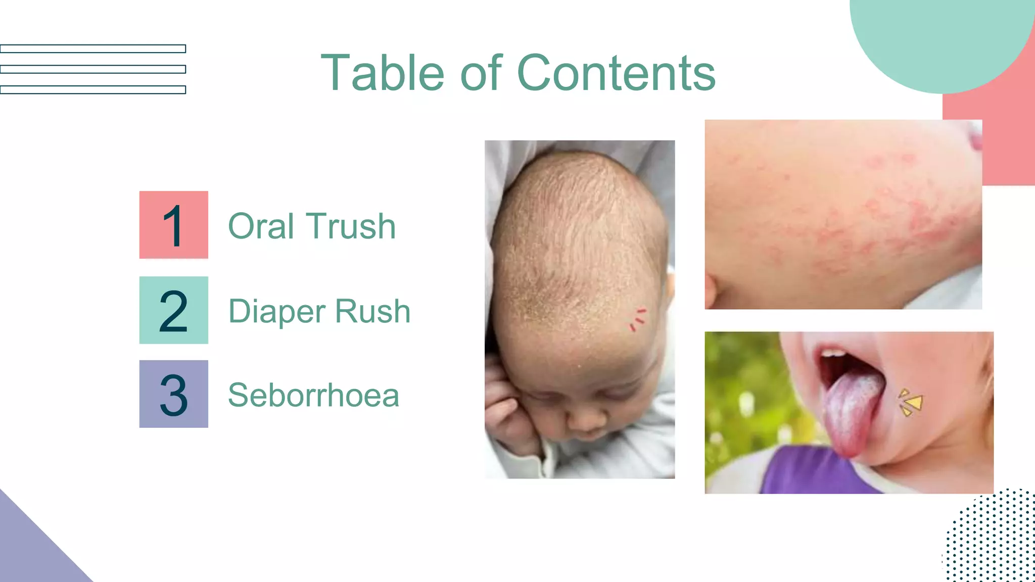 Penyulit dan Komplikasi Neonatus, bayi diaper rush, seborhea & oral ...