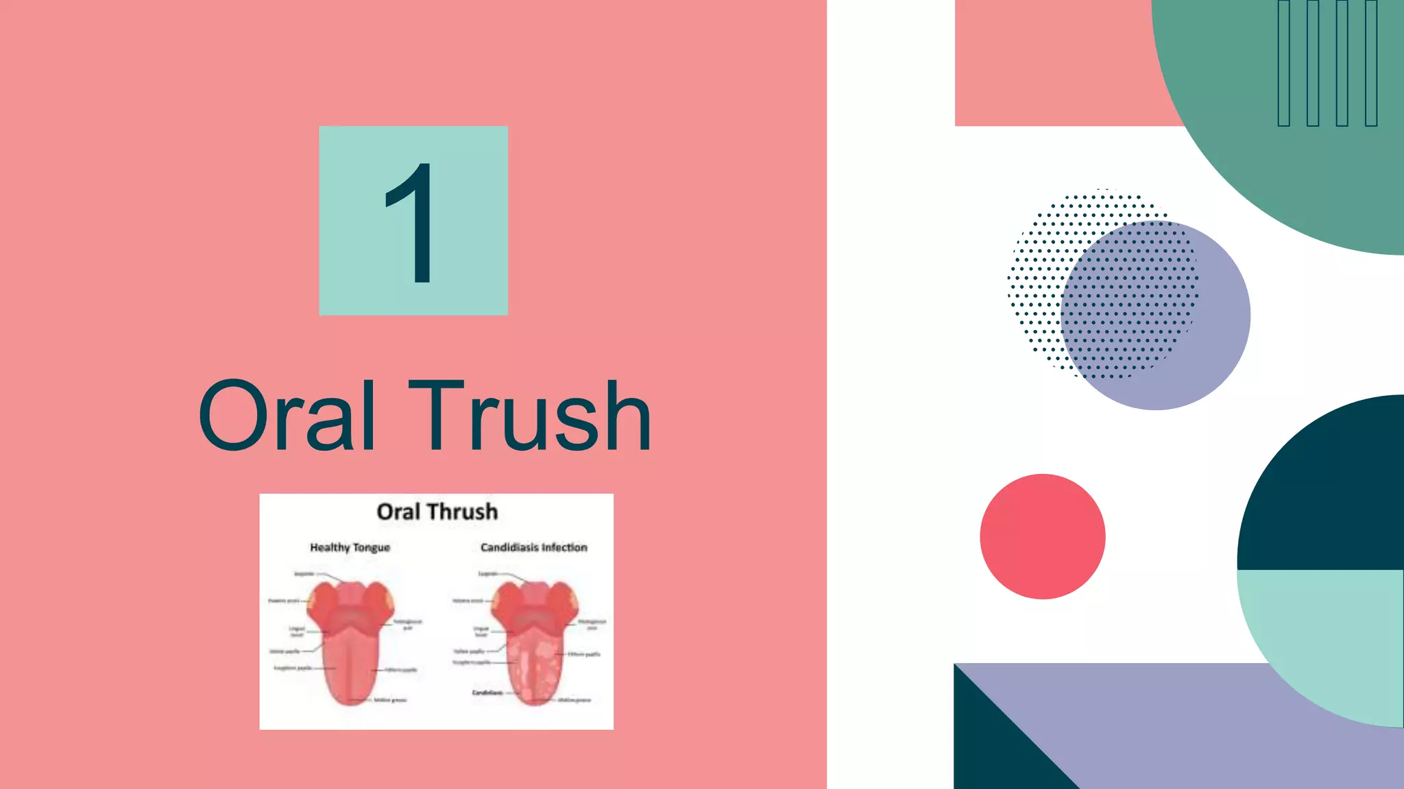 Penyulit dan Komplikasi Neonatus, bayi diaper rush, seborhea & oral ...