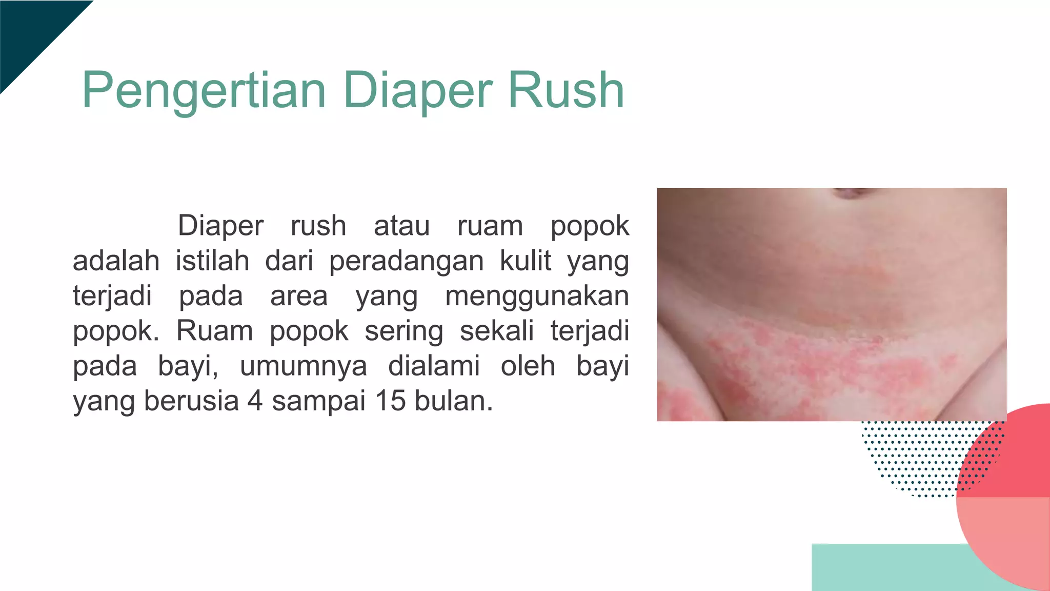 Penyulit dan Komplikasi Neonatus, bayi diaper rush, seborhea & oral trush.pptx